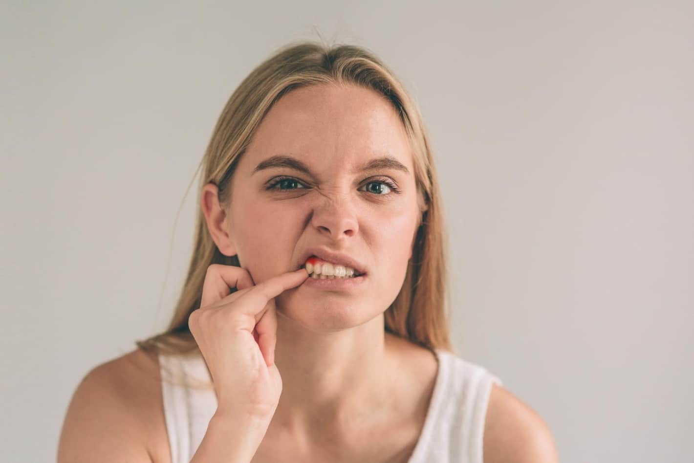 Etapas y tratamiento del absceso de las encías – Somos Dental
